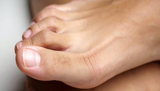 Hammer Toes | Rosendahl Foot & Shoe Center